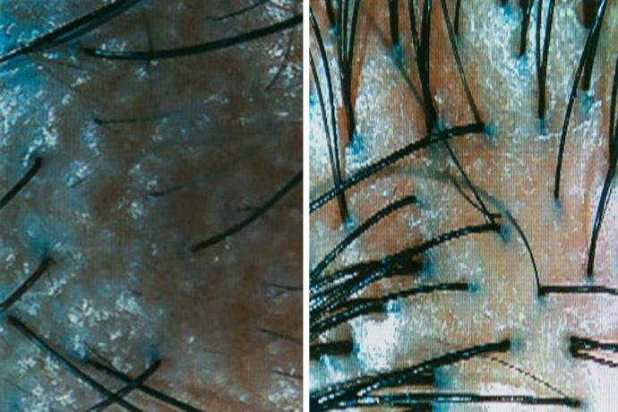 I Tried A Scalp Detox & Care Treatment To Increase Growth & Thickness