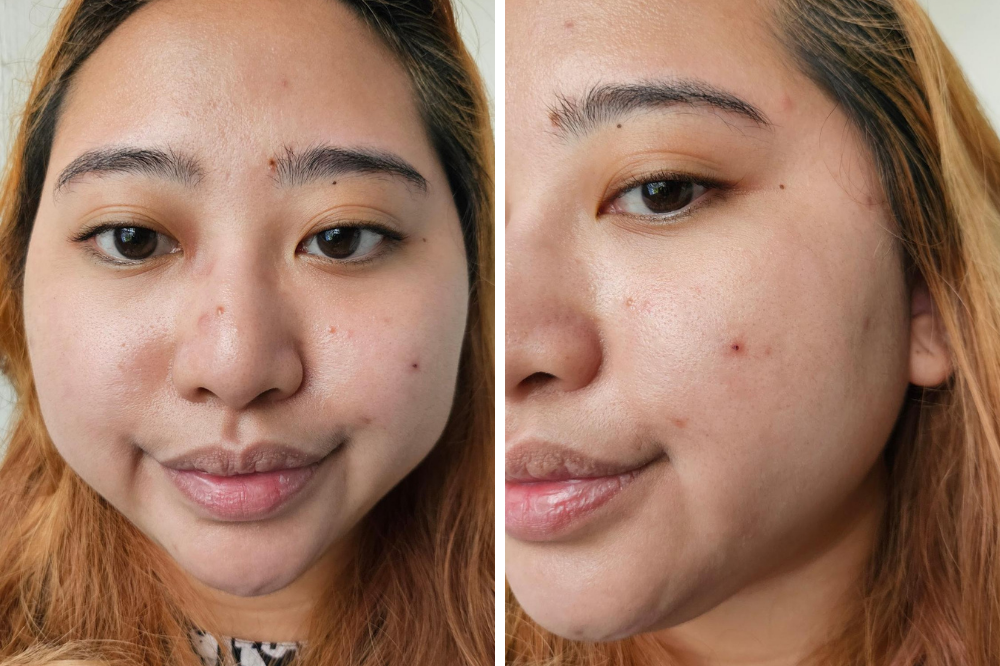 4 Girls Try The Viral Kiehl’s Invisible Liquid Patch