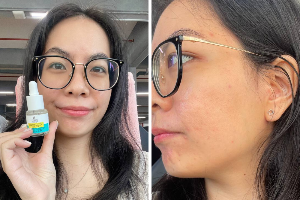 4 Girls Try The Viral Kiehl’s Invisible Liquid Patch