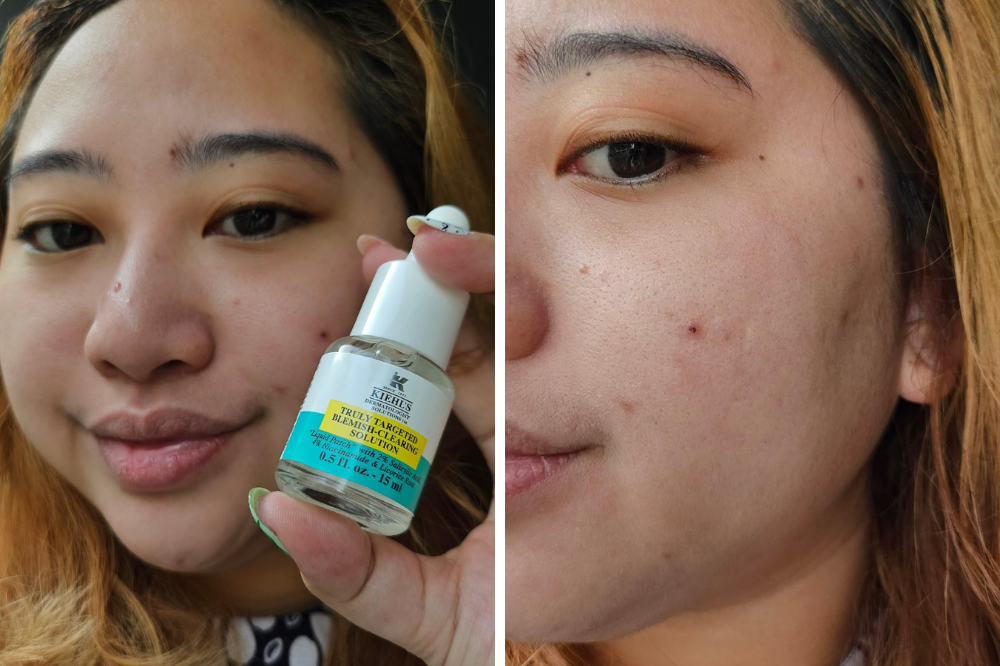 4 Girls Try The Viral Kiehl’s Invisible Liquid Patch