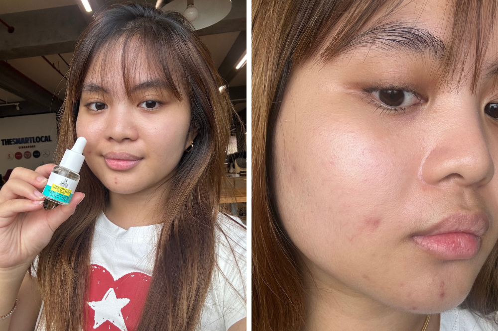 4 Girls Try The Viral Kiehl’s Invisible Liquid Patch